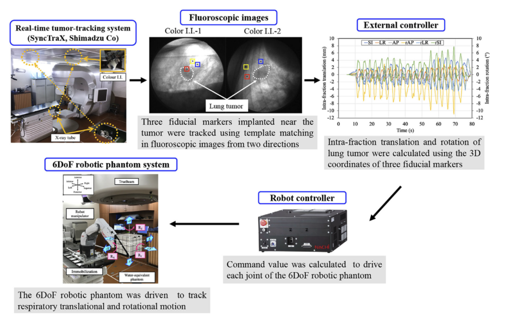 Application of Robotics Technology to Radiotherapy | 山口大学医学物理研究推進体